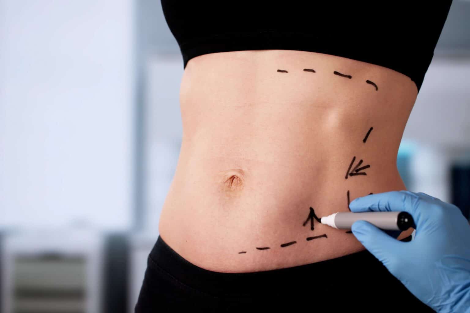 Cosmetic Surgery Salt Lake City - Plastic Surgeon Murray UT