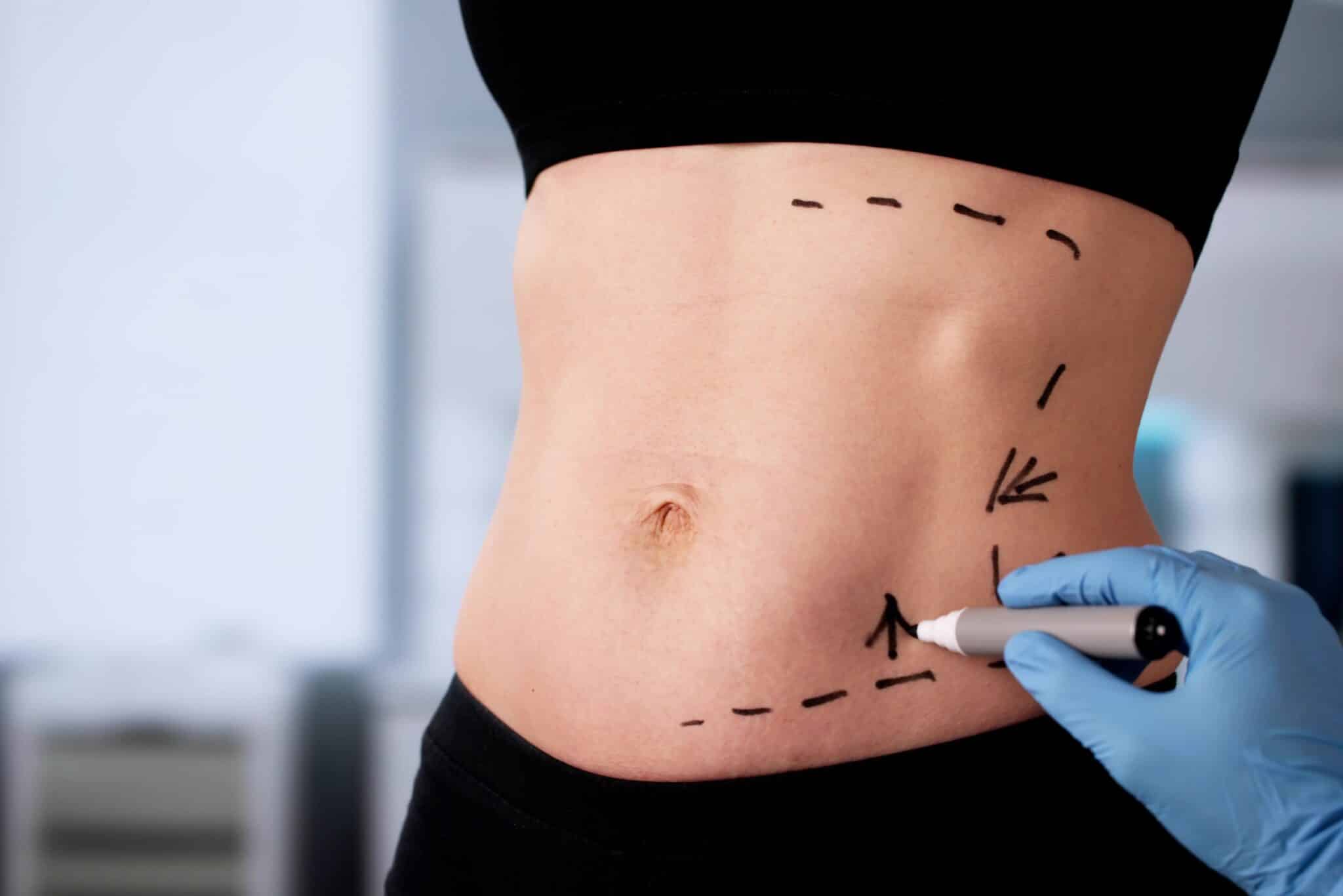 Cosmetic Surgery Salt Lake City - Plastic Surgeon Murray UT